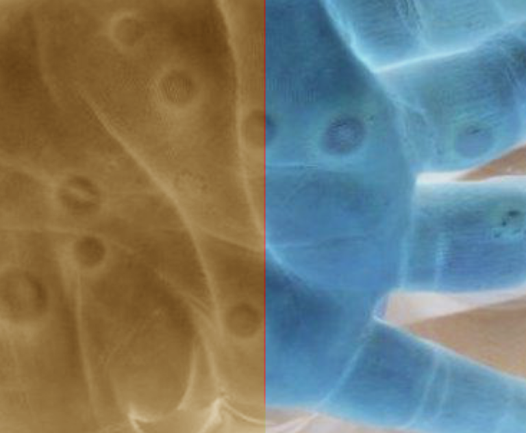 BHIVA include efficacy data on HIV and monkeypox vaccine: updated ...